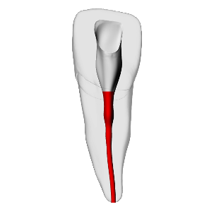 Incisor – Accessed, Basic, Clear | Dental Training Models | DRSK