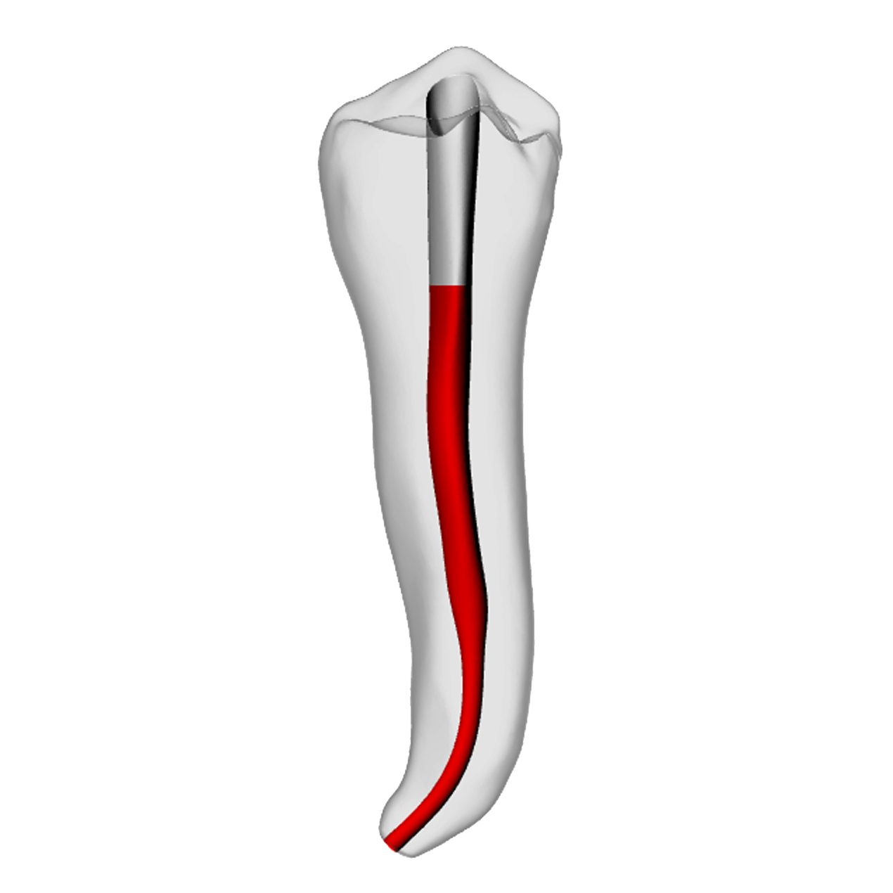 Premolar – Accessed, Apical Curve, Radiopaque (White) | Dental Training ...