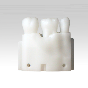 Mandibular 3-Walled Intrabony Defect | Dental Training Models | DRSK
