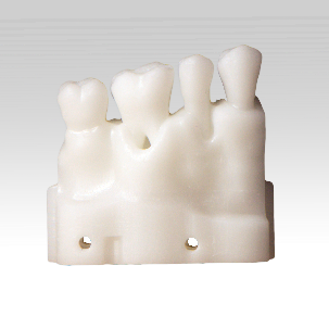 Maxillary 2-Walled Intrabony and Grade 1 Furcation Defect – Dental ...