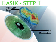 iLASIK FemtoLASIK steps | Eye of Cairo, Dr Khalil Eye Clinic