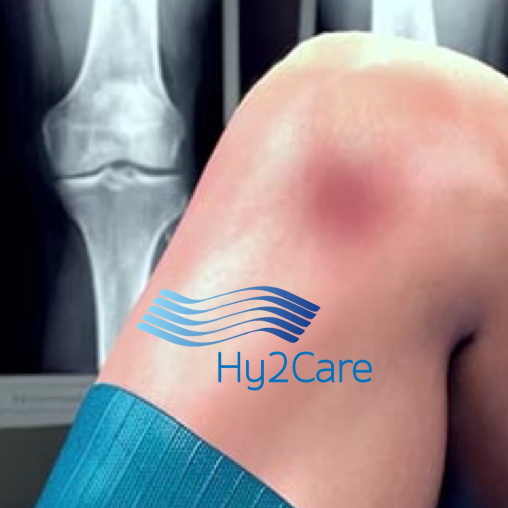 Insightfully Innovate