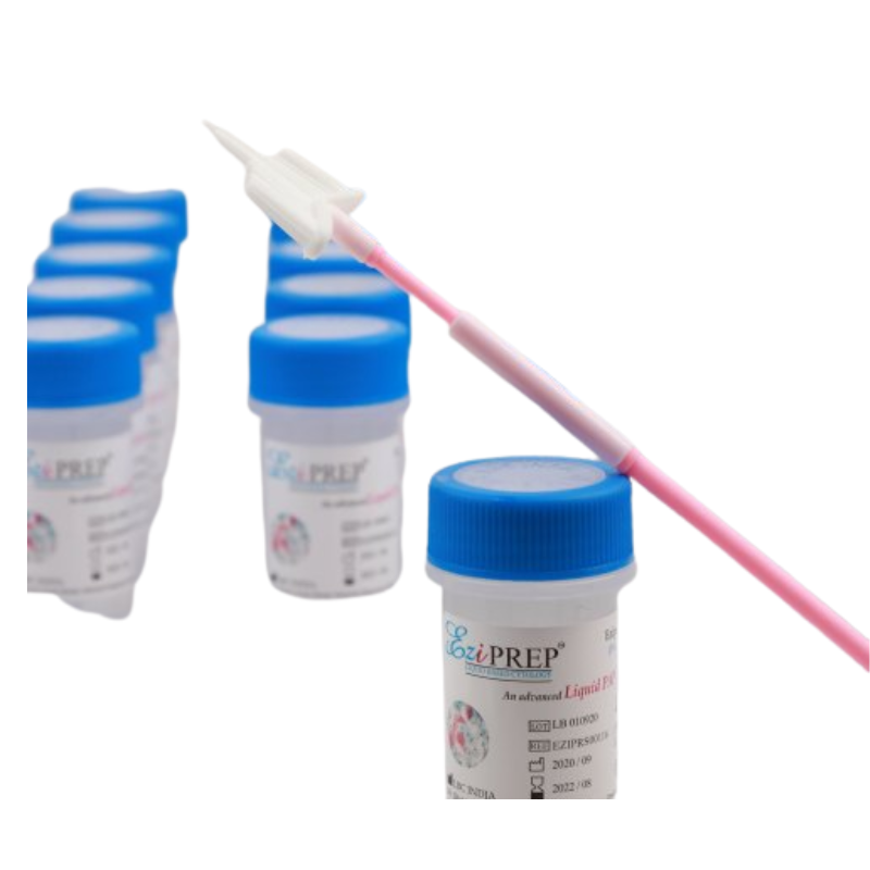 LBC KIT – ALS International Ltd