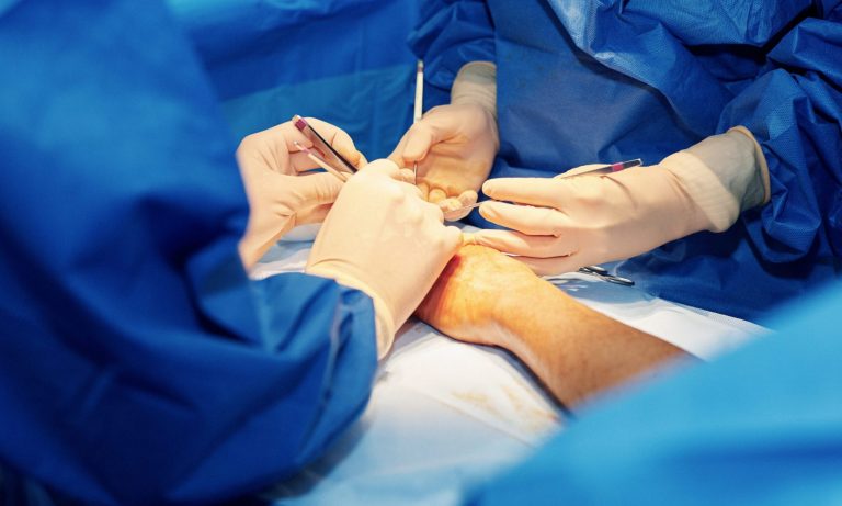 Springvinger (Flexorpees tenosynovitis) - Prof. Dr. Matthias VANHEES ...