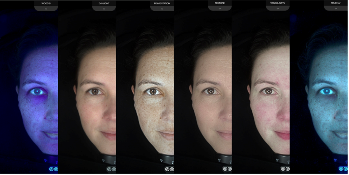 Introducing Observ Skin Analysis – HI Therapies