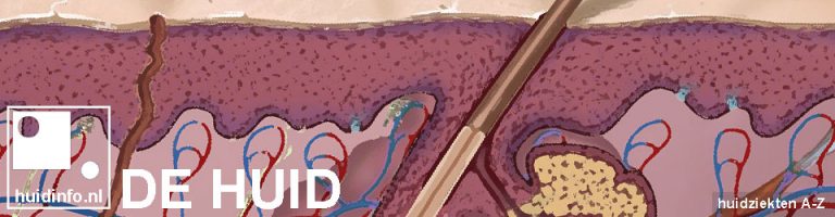 De Huid | info van de dermatoloog