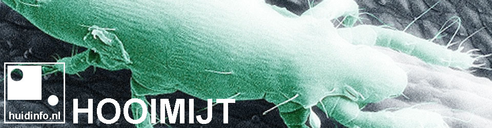 HOOIMIJT | uitleg door de dermatoloog | info van de dermatoloog