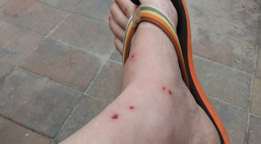 Vlooien bestrijden in huis? Zo kun je ze zelf verdelgen - Huishoudwiki ...