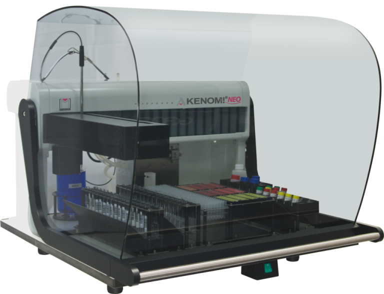 IFA and Autoimmune diseases – LabLab