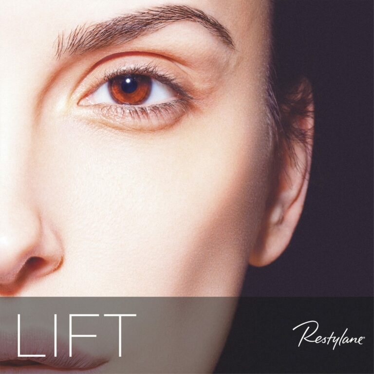 Kindben og løft med filler - Midase Clinic