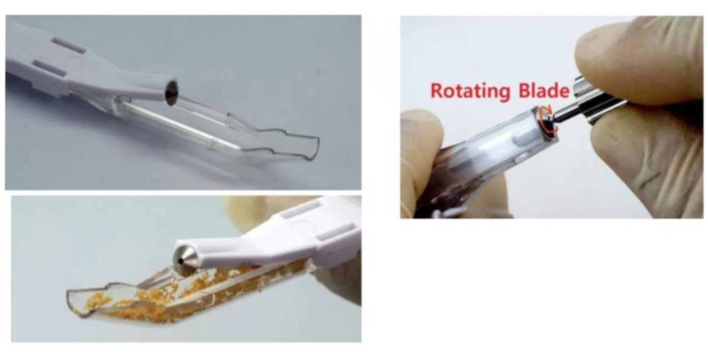 Optimize Your Surgical Procedures with Osung USA’s Bone Scraper ...