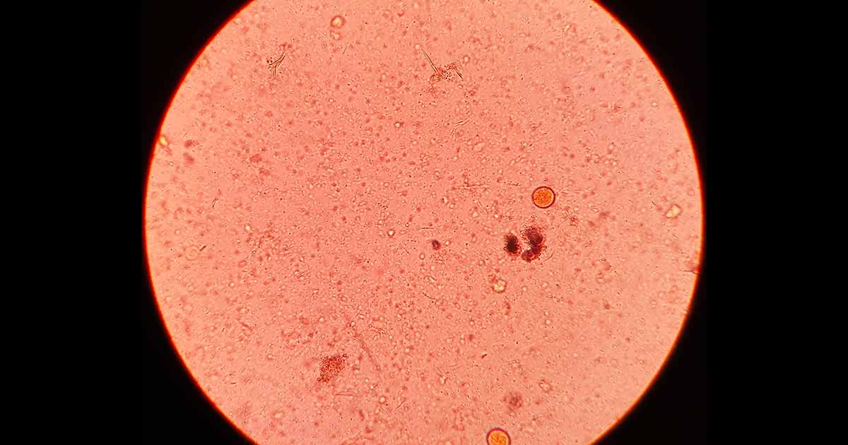 Blastocystis - ParasiteClinic