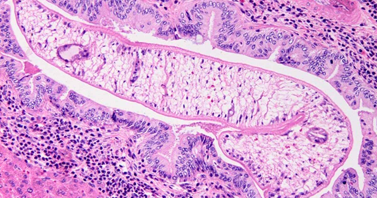 Flukes Overview – ParasiteClinic