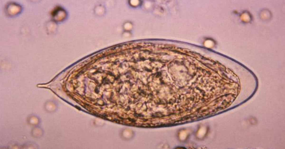 Flukes Overview – ParasiteClinic
