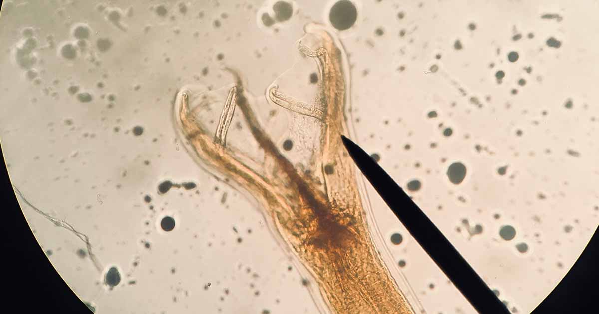 Worms Overview – ParasiteClinic