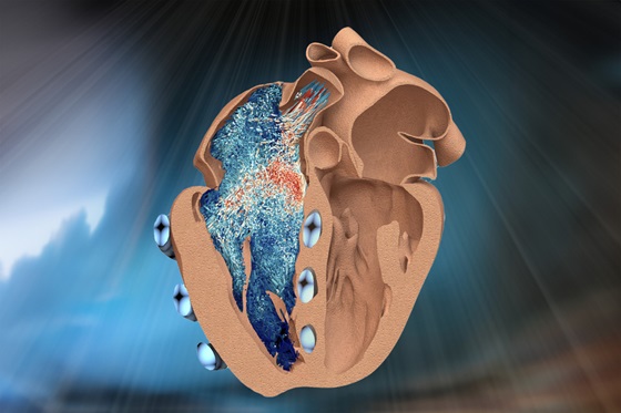 MIT Engineers Craft Robotic Replica of Heart’s Right Chamber ...