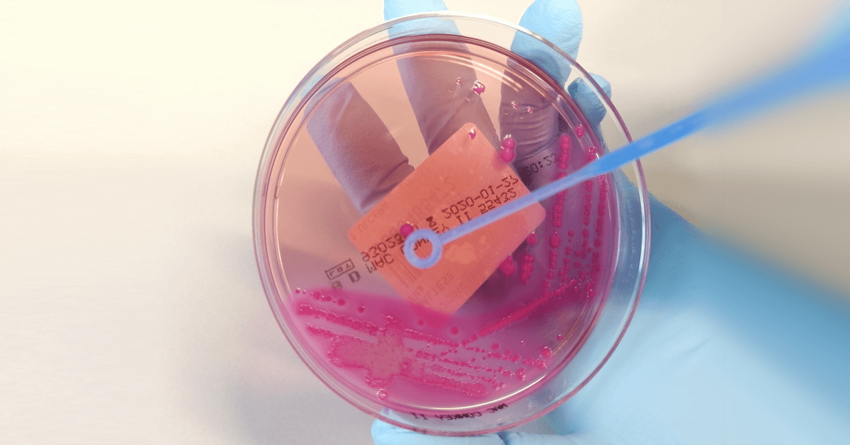 Biosafety and In-Vitro Diagnostics | SAXOCON A/S