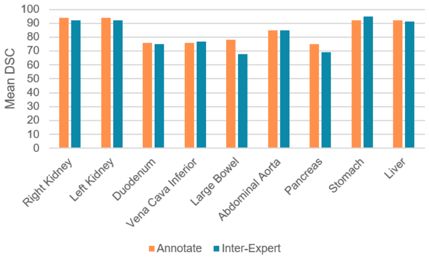 MR-guided radiotherapy: a new hope for pancreatic cancer? - TheraPanacea