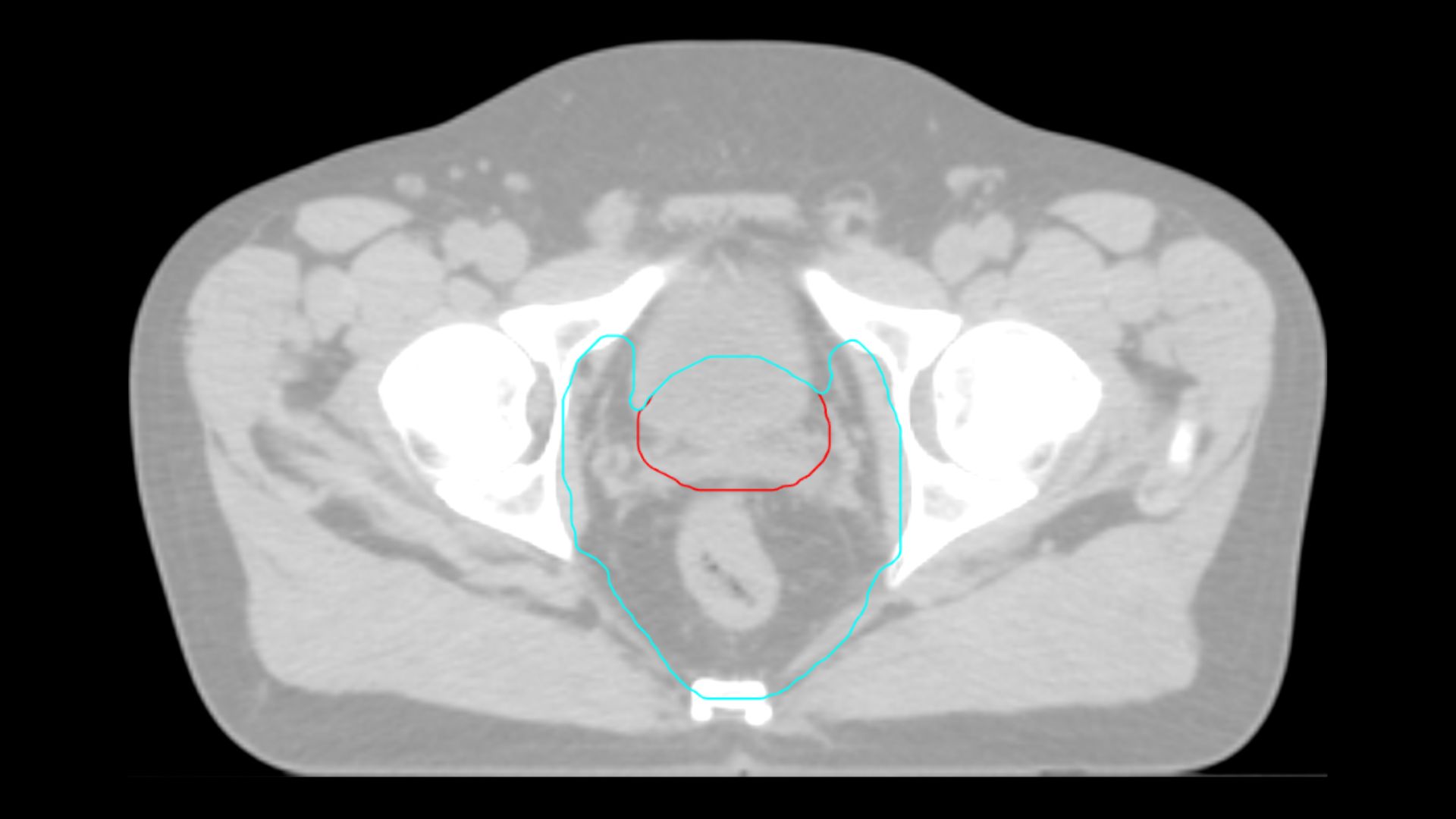 AdaptBox - TheraPanacea