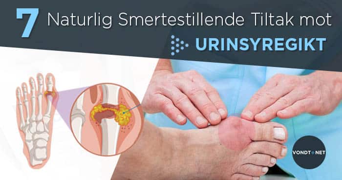 7 Naturlig Smertestillende Tiltak og Behandling mot Urinsyregikt