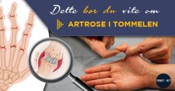 Artrose i Tommelen | Årsak, Symptomer, Forebygging, Øvelser, Behandling